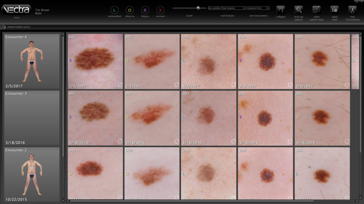 Scanner Corps entier - innovation dépistage